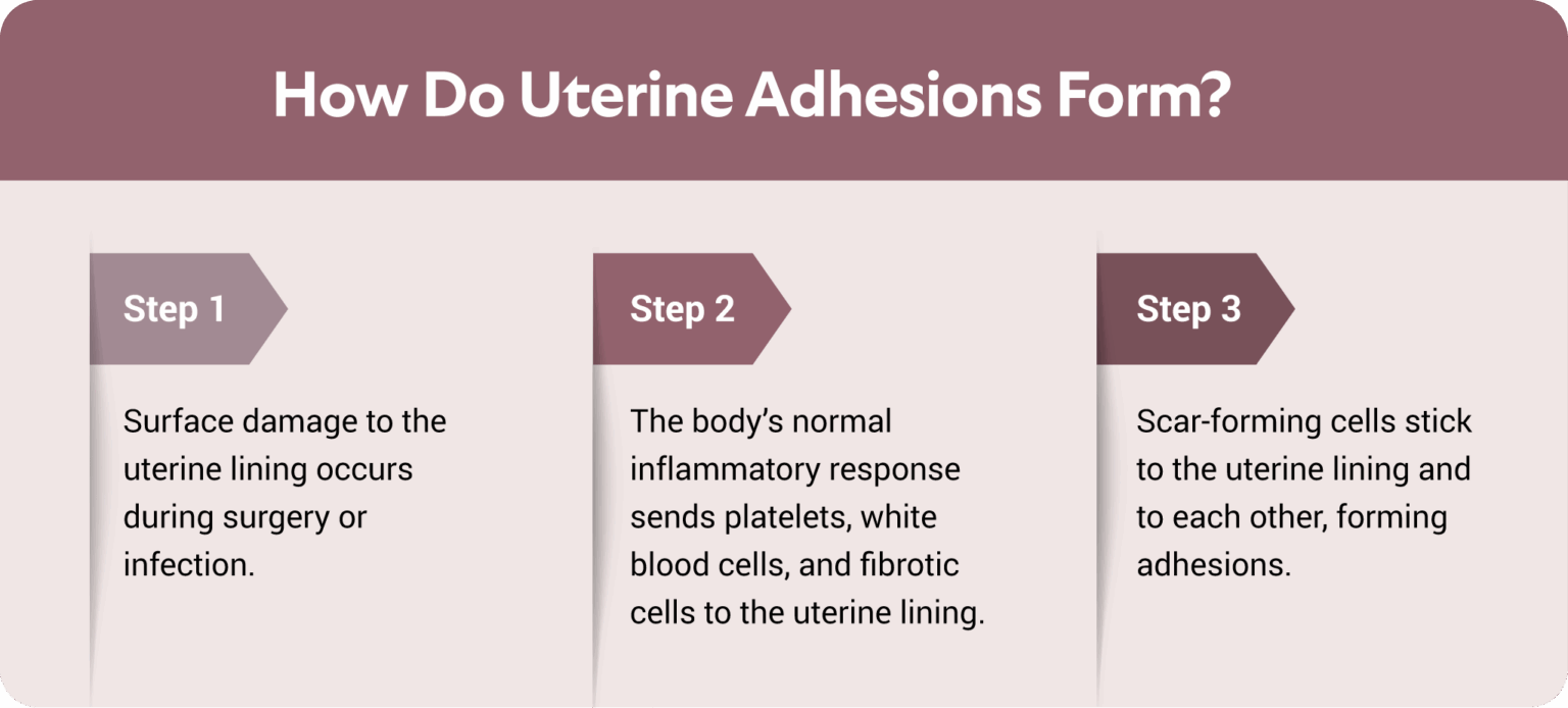 Hysteroscopic Scar Tissue Removal (Lysis of Adhesions): What It Is and ...
